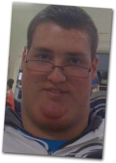 Learn how to lose face fat NOW - Moose and Doc